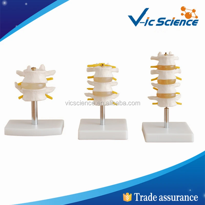 Medical Lumbar Spine Model(2pcs,3pcs,4pcs) - Buy Lumbar Spine Model ...