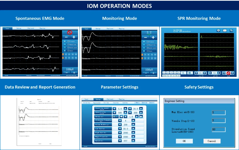 Intraoperative Monitoring Medical Device For The Monitoring Of The ...