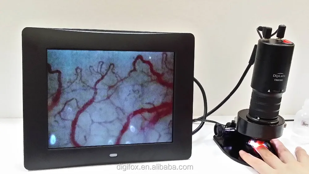Dmx980-1 Biological Microcirculation Microscope,Nail Fold Capillary ...