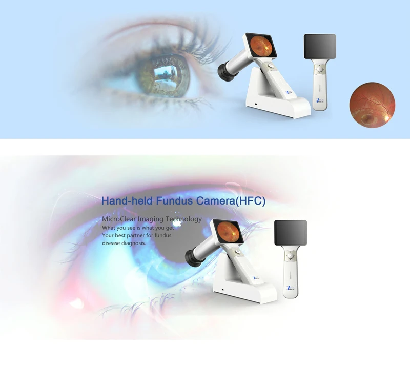 Top View Fundus Camera - Digital Retinal Eye Exam Handheld