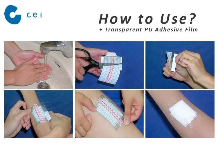 Transparent Occlusive Dressing Hypoallergenic Transparent Dressing ...