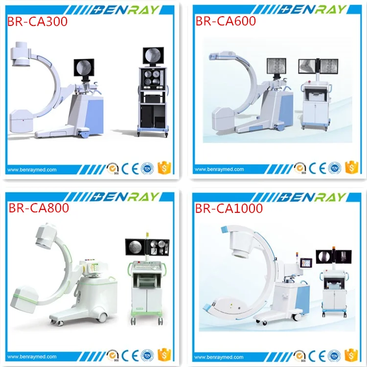 Br-ca1000 Mobile Digital X Ray Machine X-ray Processor Types Of X Ray ...