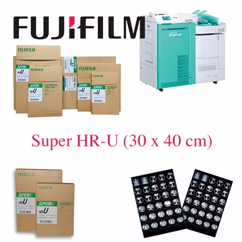 Medical Fujifilm Super Hr-u (30*40) 100 Sh - Medical Wet Imaging Film ...