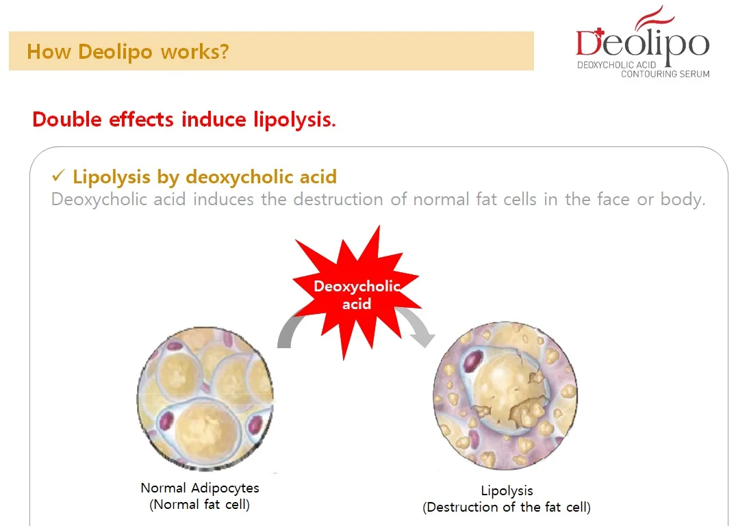 Deoxycholic Acid Face Contour & Lipolysis Injection "deolipo(kabelline ...