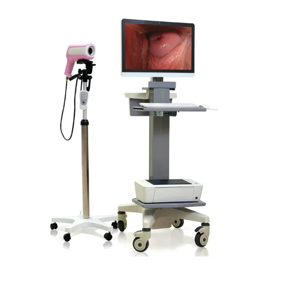 Digital Video Olympus Colposcope System Equipment - Buy Olympus ...